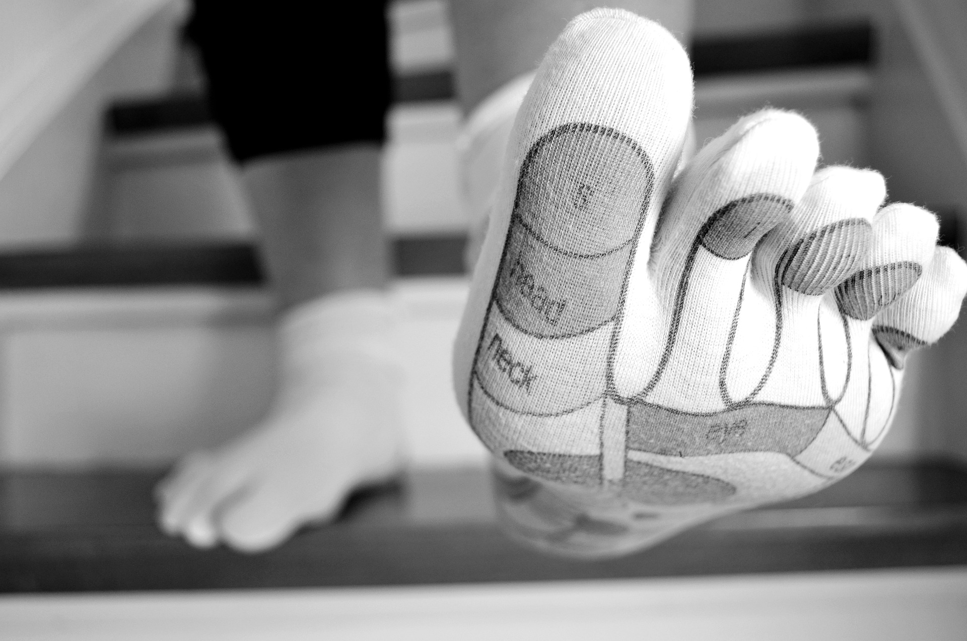 Apa itu Hammer Toe; Jari Bengkok - Gejala, Penyebab dan Pengobatan ...